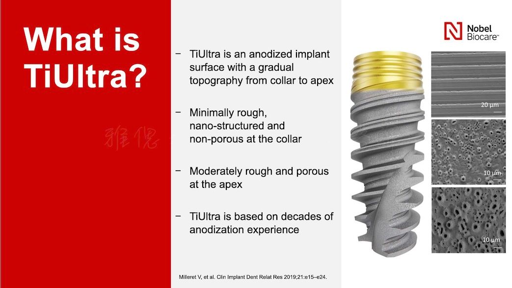 Nobel Biocare 諾保科植體全解析：瑞典植牙品牌優勢與All-on-4應用