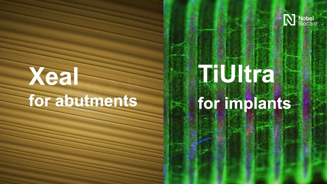 Nobel Biocare 諾保科植體全解析：瑞典植牙品牌優勢與All-on-4應用